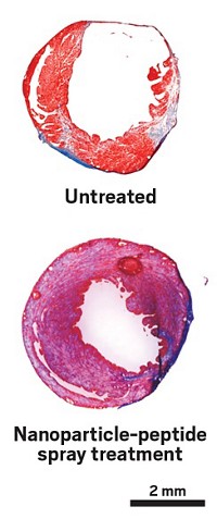 Synthetic-Platelets-Boost-Clotting