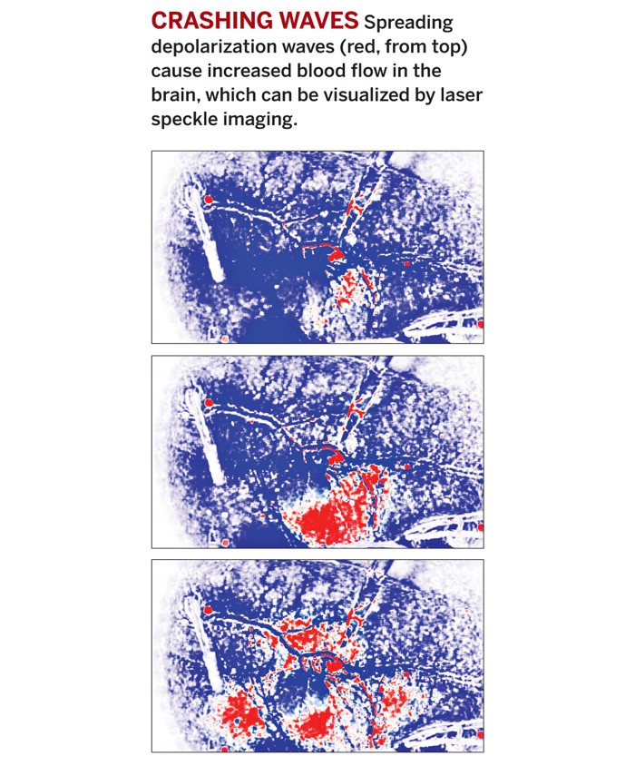 Brain-Glucose-Drop-Drop