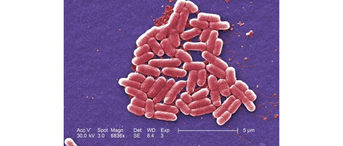 Deadly E. Coli Strain May Evade EPA's Test