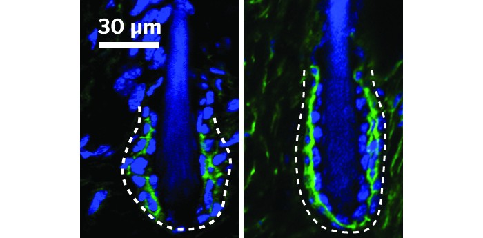 One Molecule Makes Stem Cells Grow Hair ...