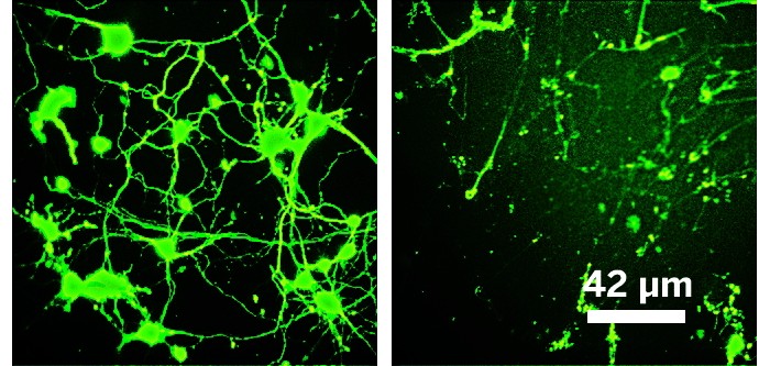 Amyloid-β Gets Toxic Helping Hand