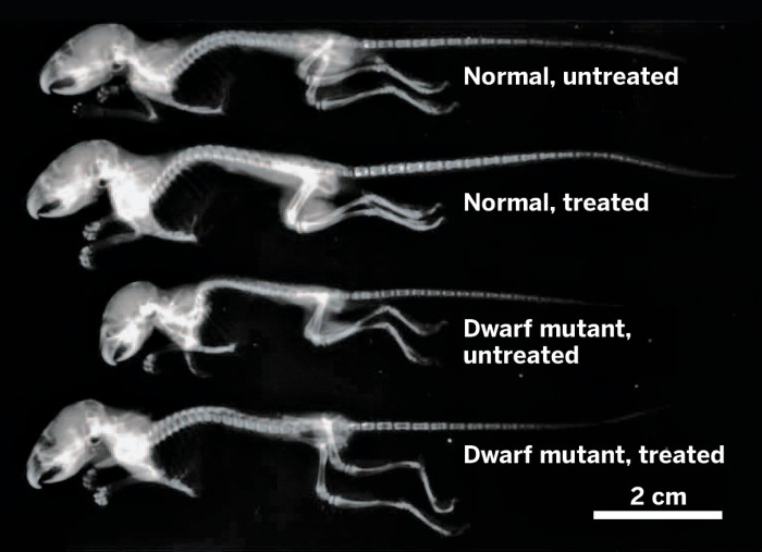 Putting An End To One Type Of Dwarfism