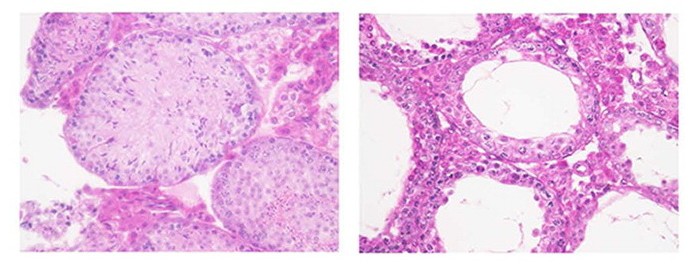 Reversible Male Contraception With Gold Nanorods
