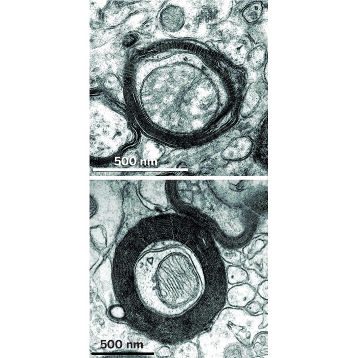 Compound Protects Brain Cells From Explosive Force