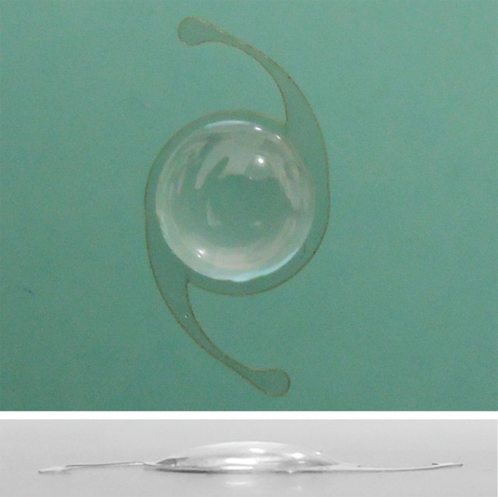 A Liquid Lens Could Improve Cataract Treatment