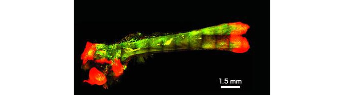 Making bone transparent