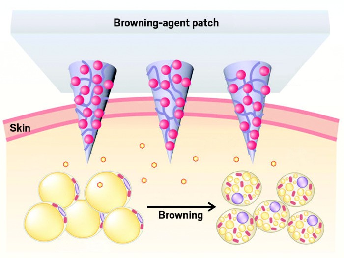 Microneedle skin patch fights fat