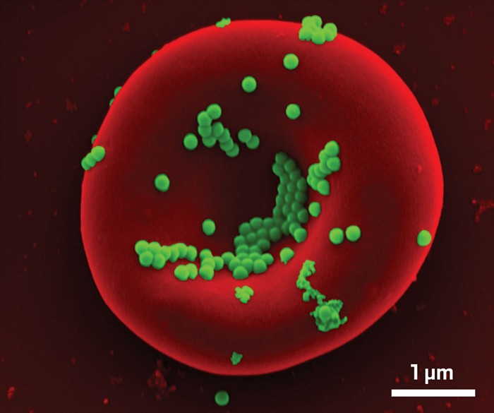 Letting nanoparticles hitchhike on red blood cells