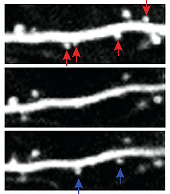 Ketamine helps neurons regrow lost connections