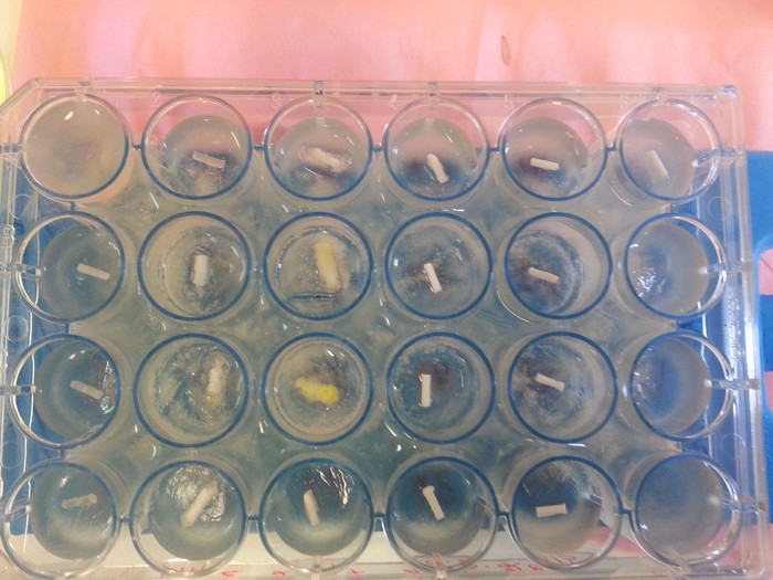 Biodegradable breast biopsy markers