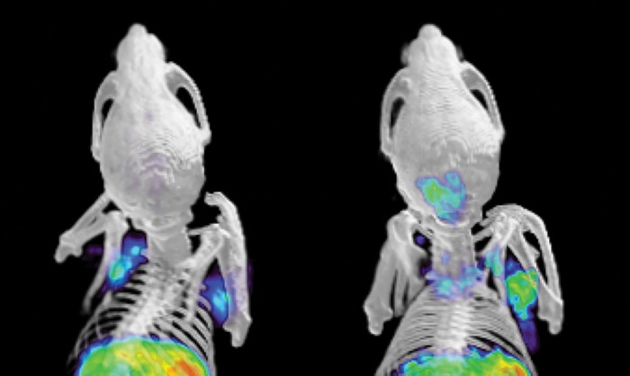 New PET probes light up bacteria in deep-seated infections