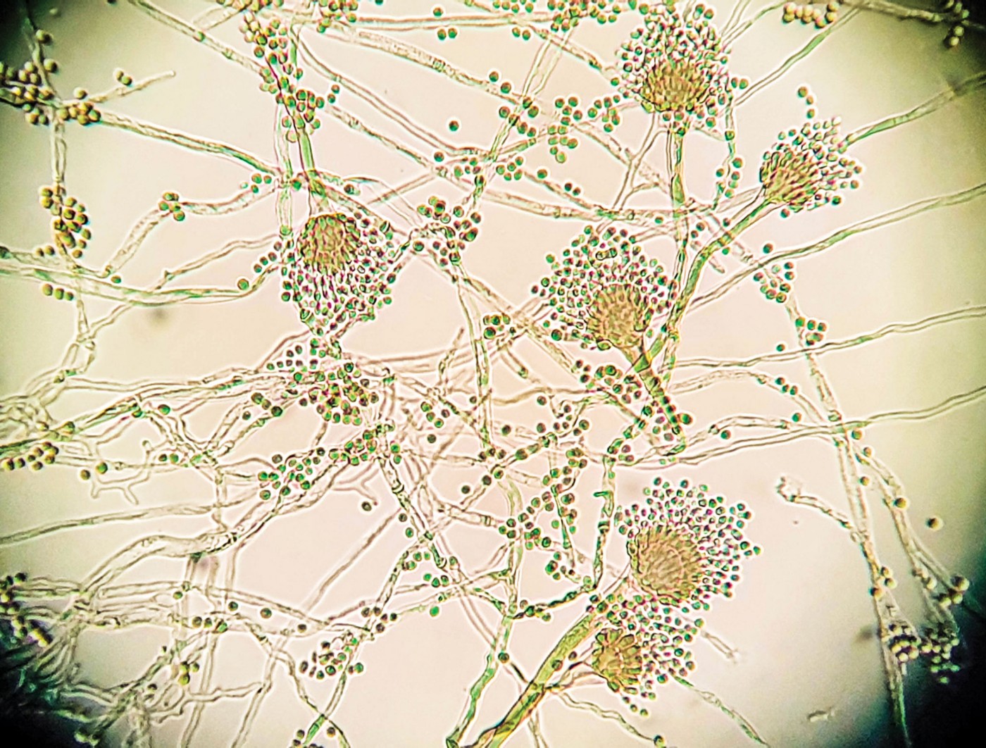 Types Of Fungi On Humans
