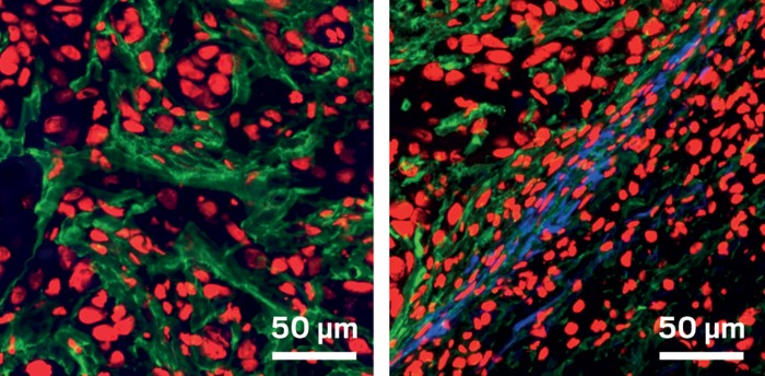 Visualizing Cross Linking In Collagen